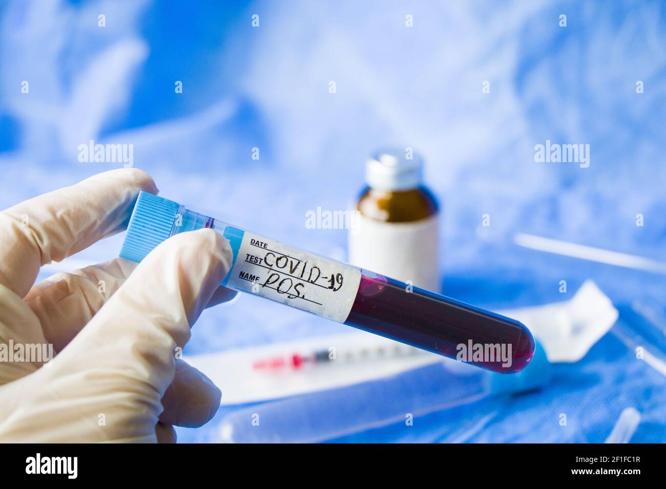 A closeup of a doctor in latex gloves holding a COVID-19 POSITIVE test ...