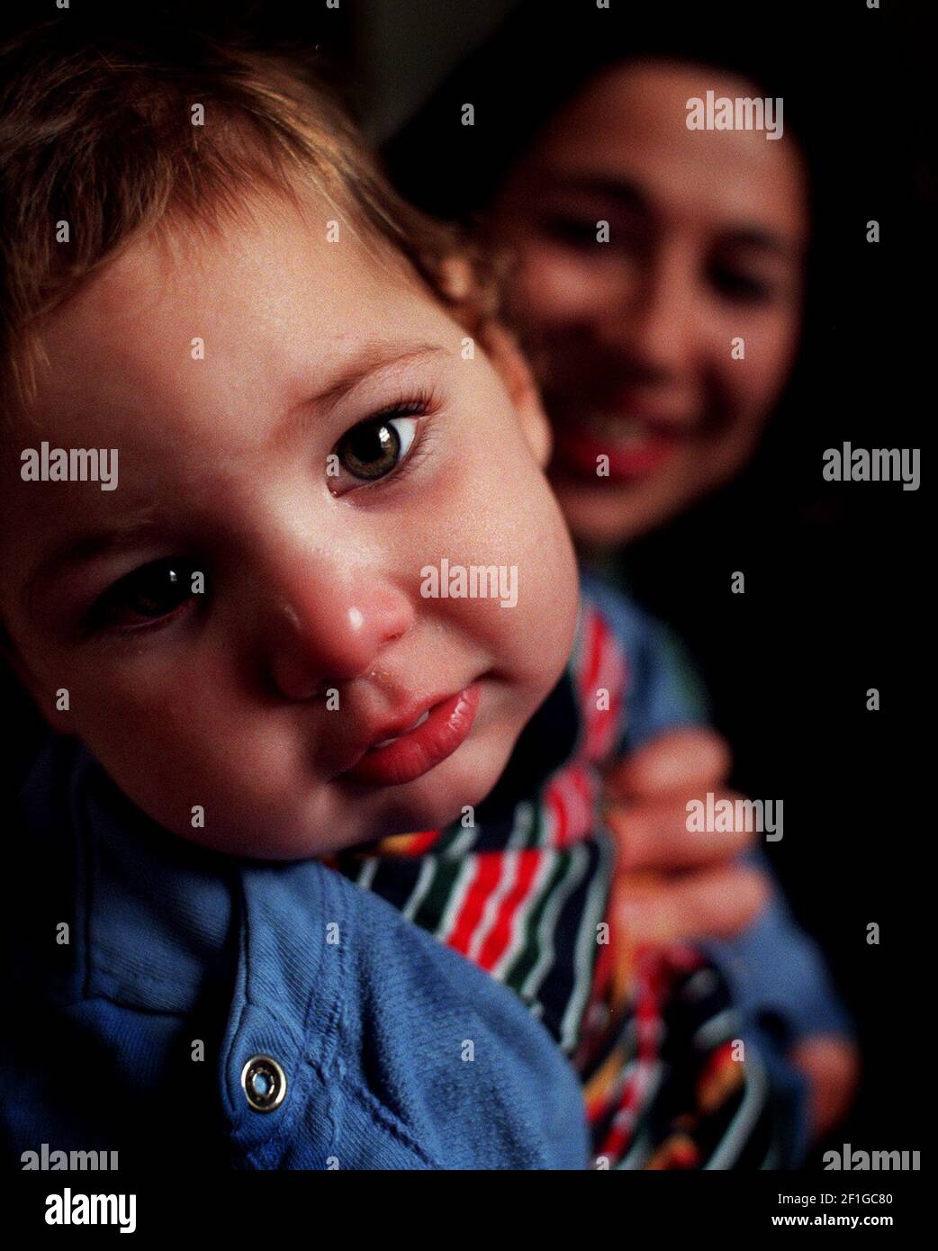Brain Damaged Child October 1998 Stock Photo - Alamy
