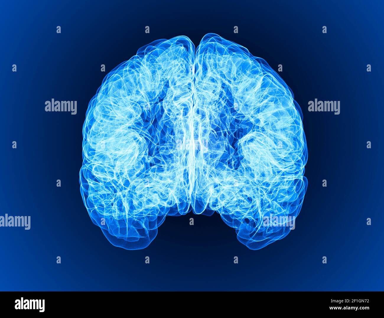 Pain in the head, brain and synapses, cognitive problems, mental ...