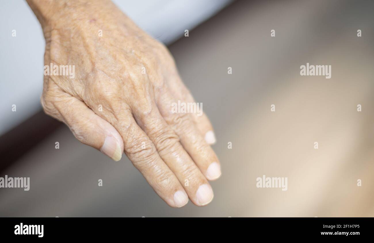 Hand back of Old man's with wrinkle skin of senior or older man Stock ...