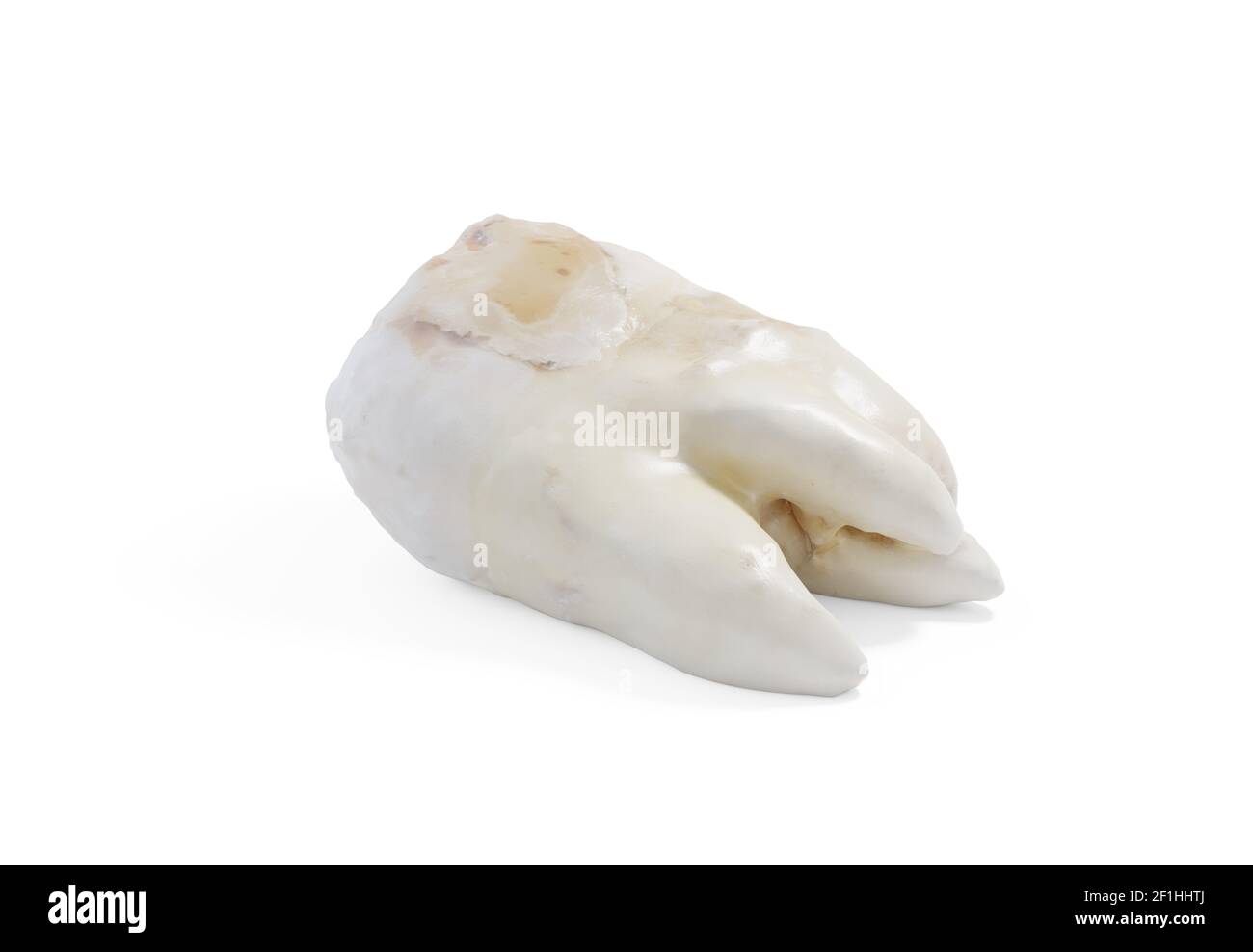 Extracted caries tooth on isolated a white background 3d illustration ...