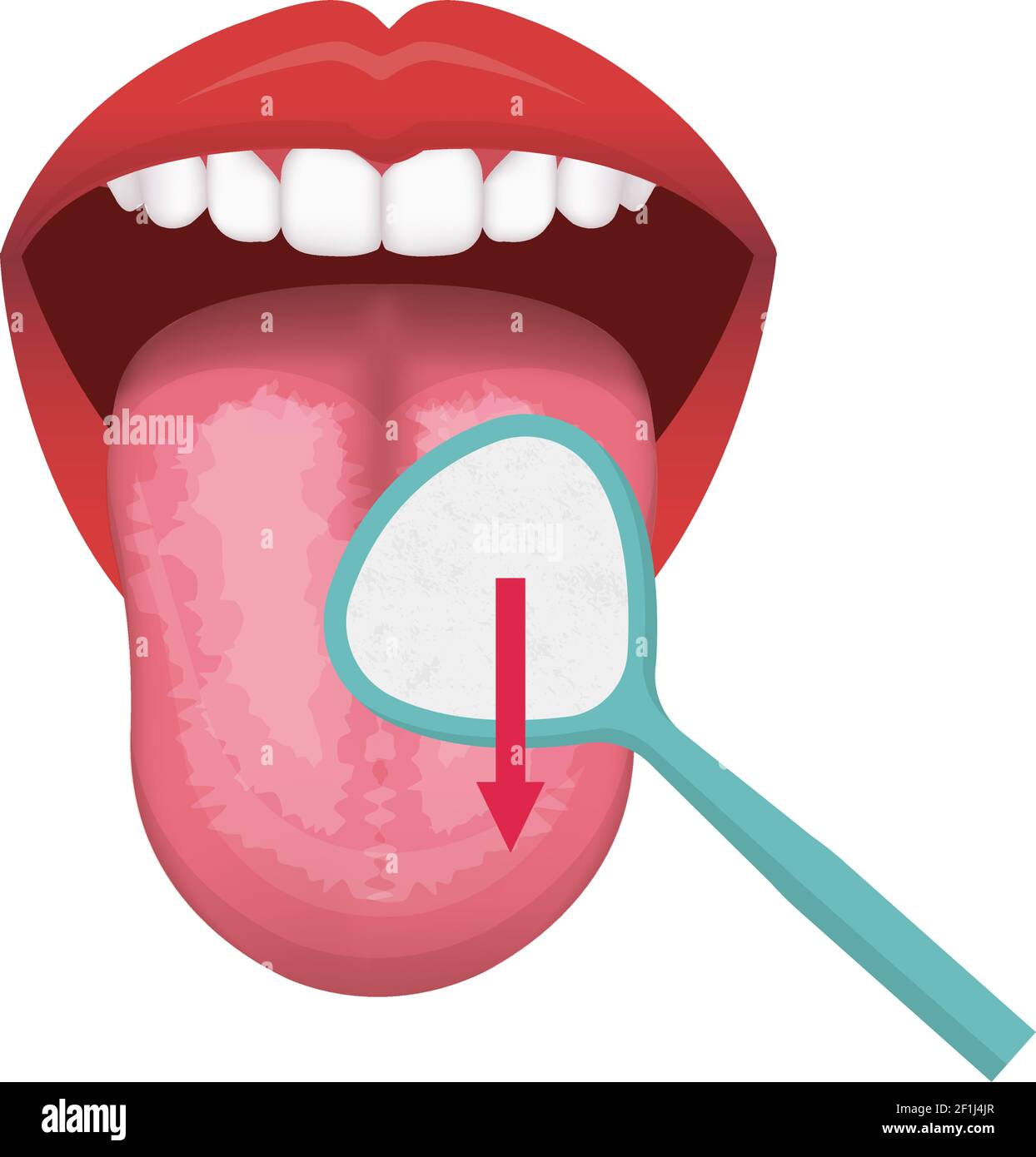 Tongue cleaning vector illustration (Halitosis prevention Stock Vector ...