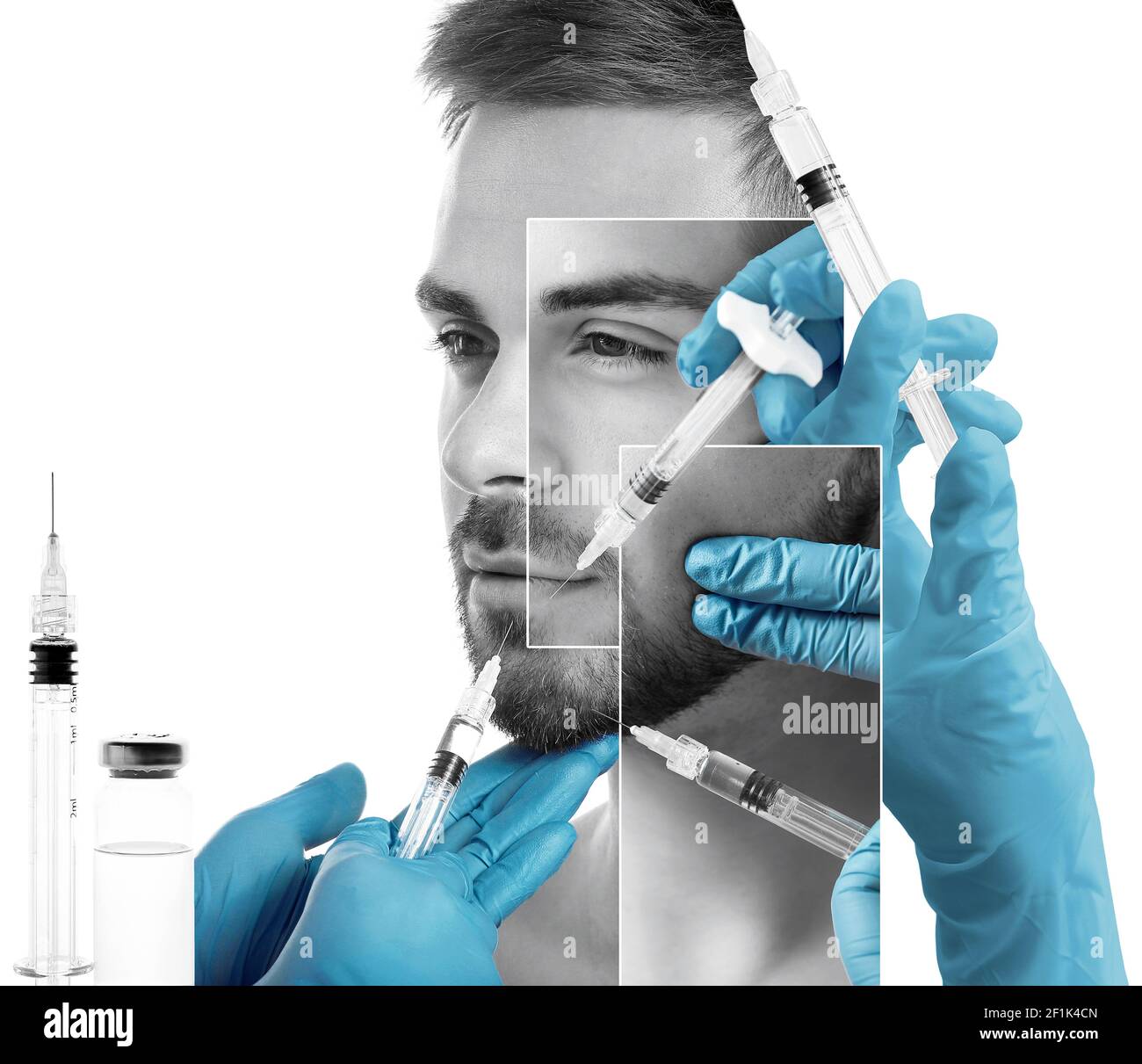 Collage of young man receiving filler injections on white background ...