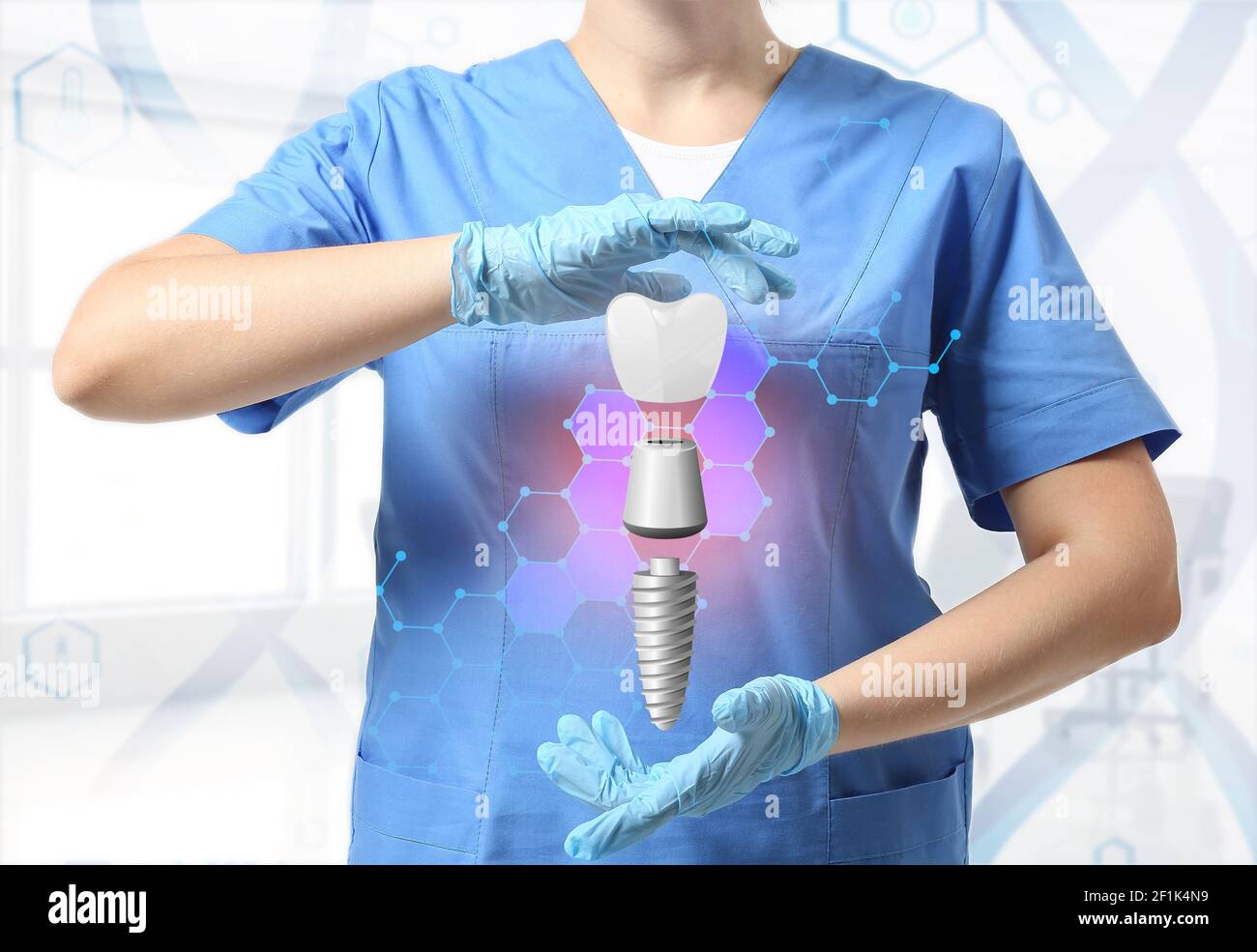 Dentist with digital model of tooth implant in clinic Stock Photo - Alamy