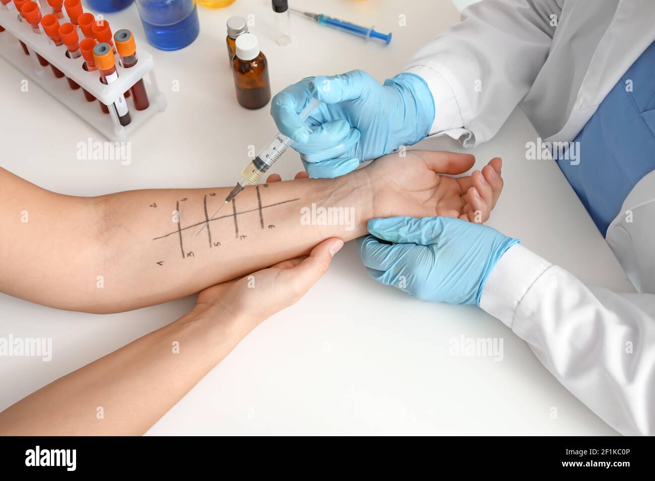 Young woman undergoing procedure of allergen skin tests in clinic Stock ...