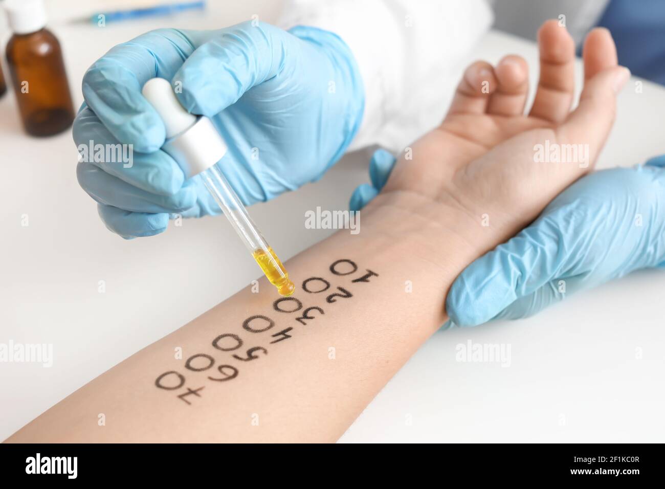 Young woman undergoing procedure of allergen skin tests in clinic Stock ...