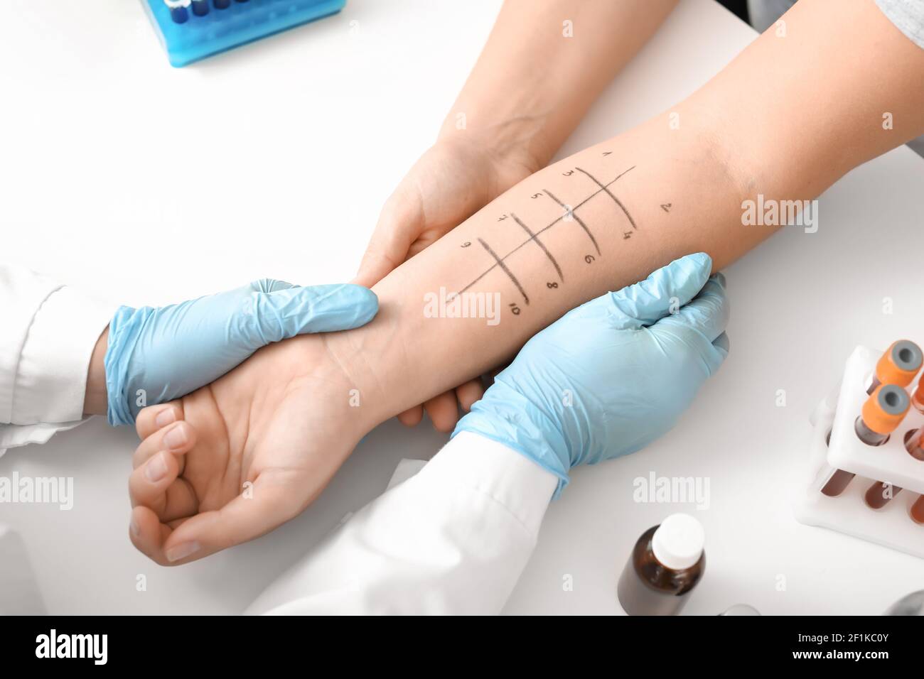 Young woman undergoing procedure of allergen skin tests in clinic Stock ...