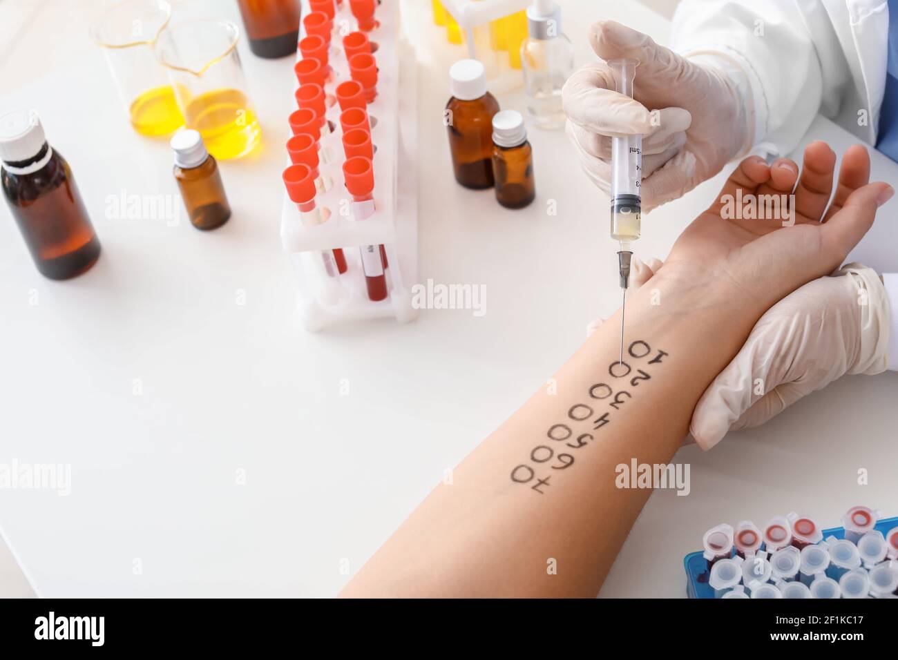 Young woman undergoing procedure of allergen skin tests in clinic Stock ...