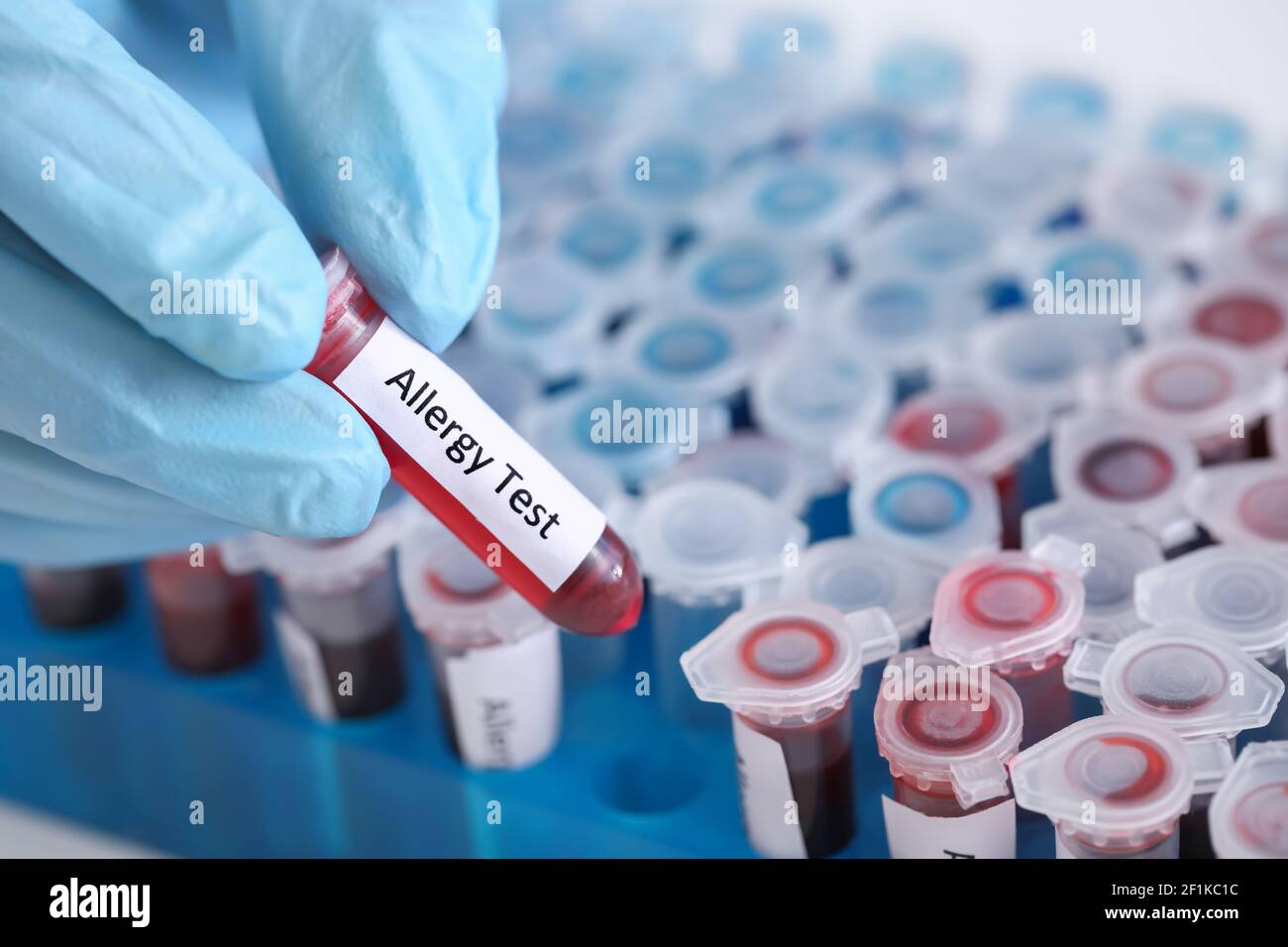 Allergy test reaction hi-res stock photography and images - Alamy