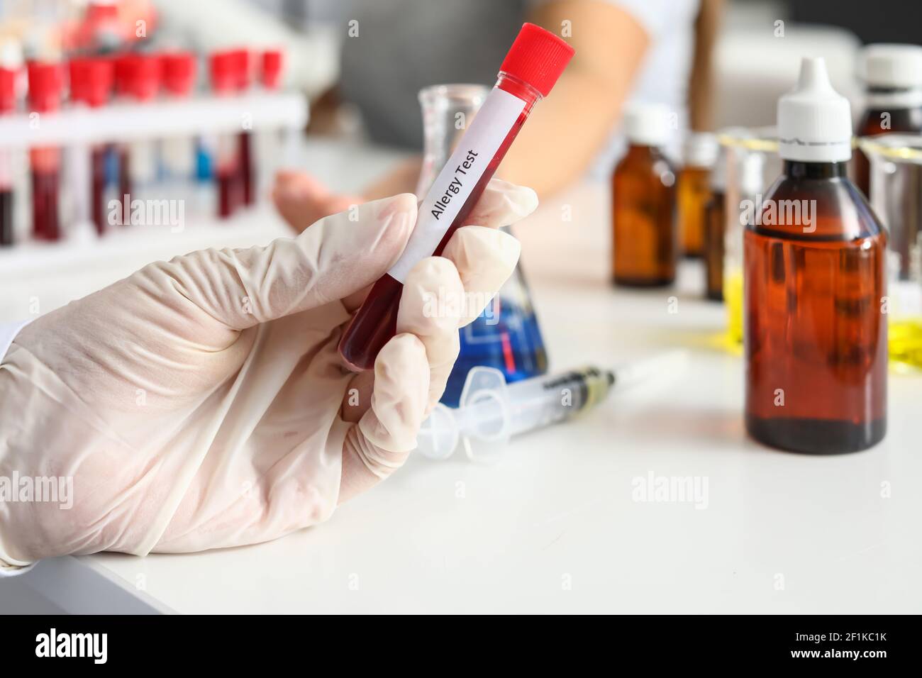 Allergy test reaction hi-res stock photography and images - Alamy