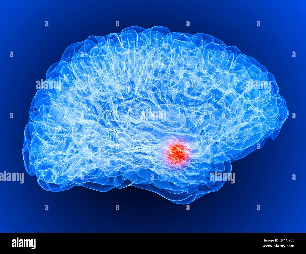 Pain in the head, brain and synapses, cognitive problems, mental ...