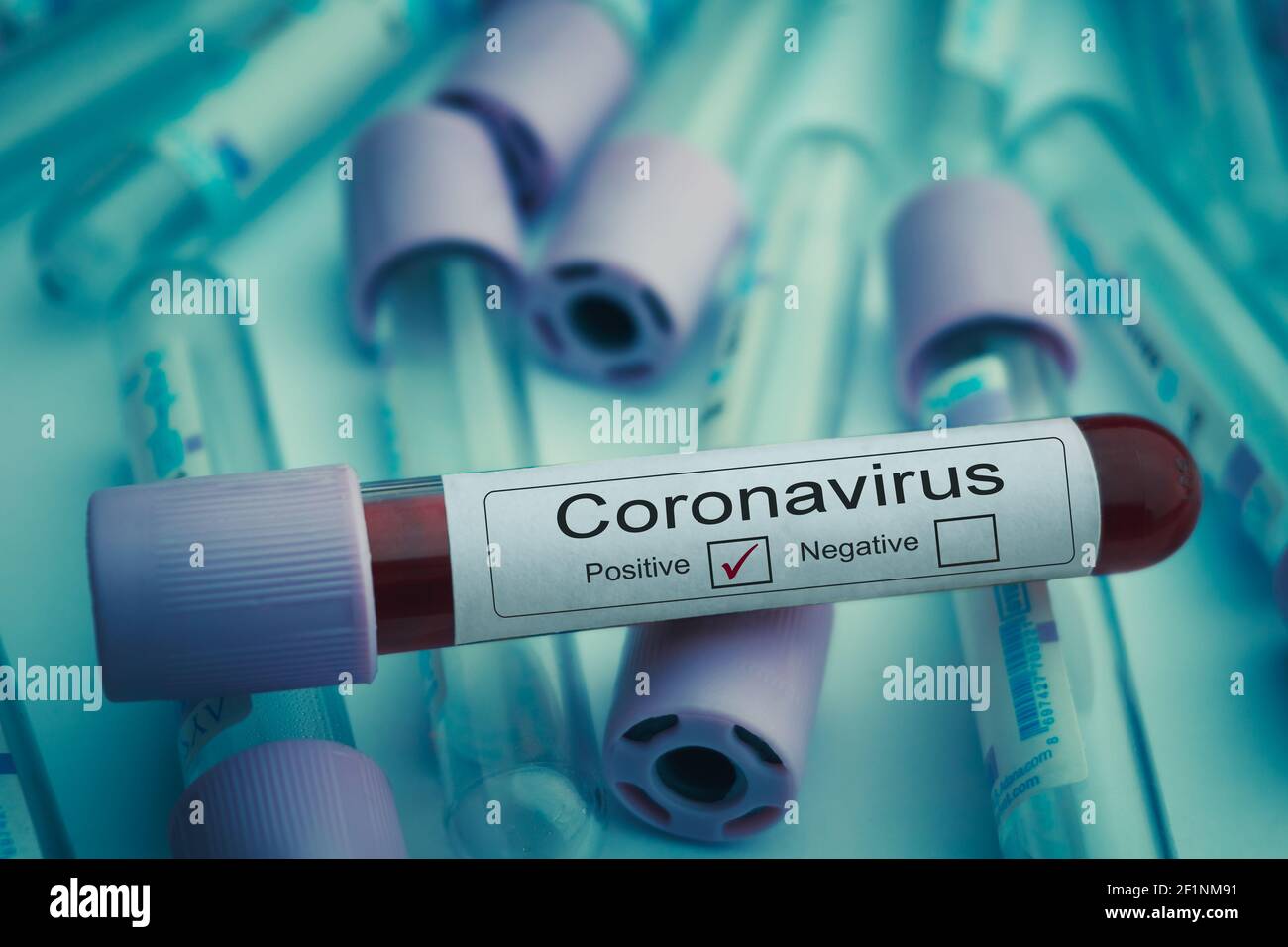 Positive pcr test text hi-res stock photography and images - Alamy