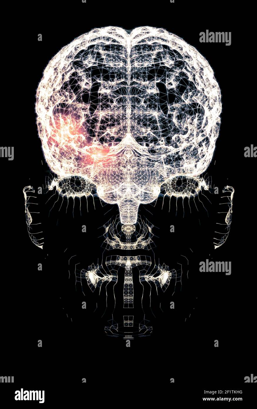 Pain in the head, brain and synapses, cognitive problems, mental ...