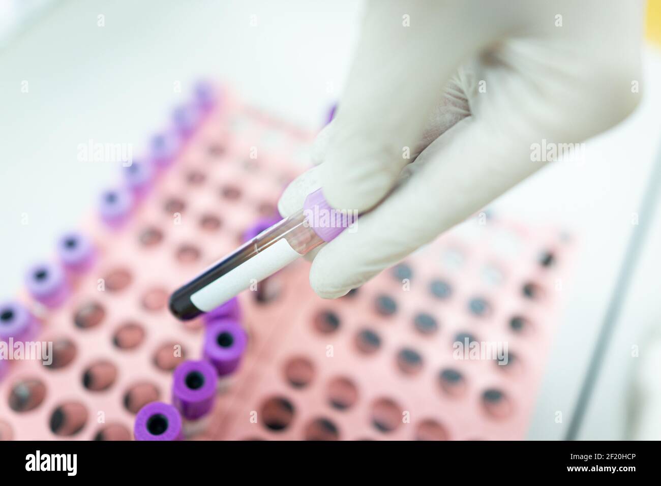 Hospital samples of donated blood indoors, high quality Stock Photo - Alamy