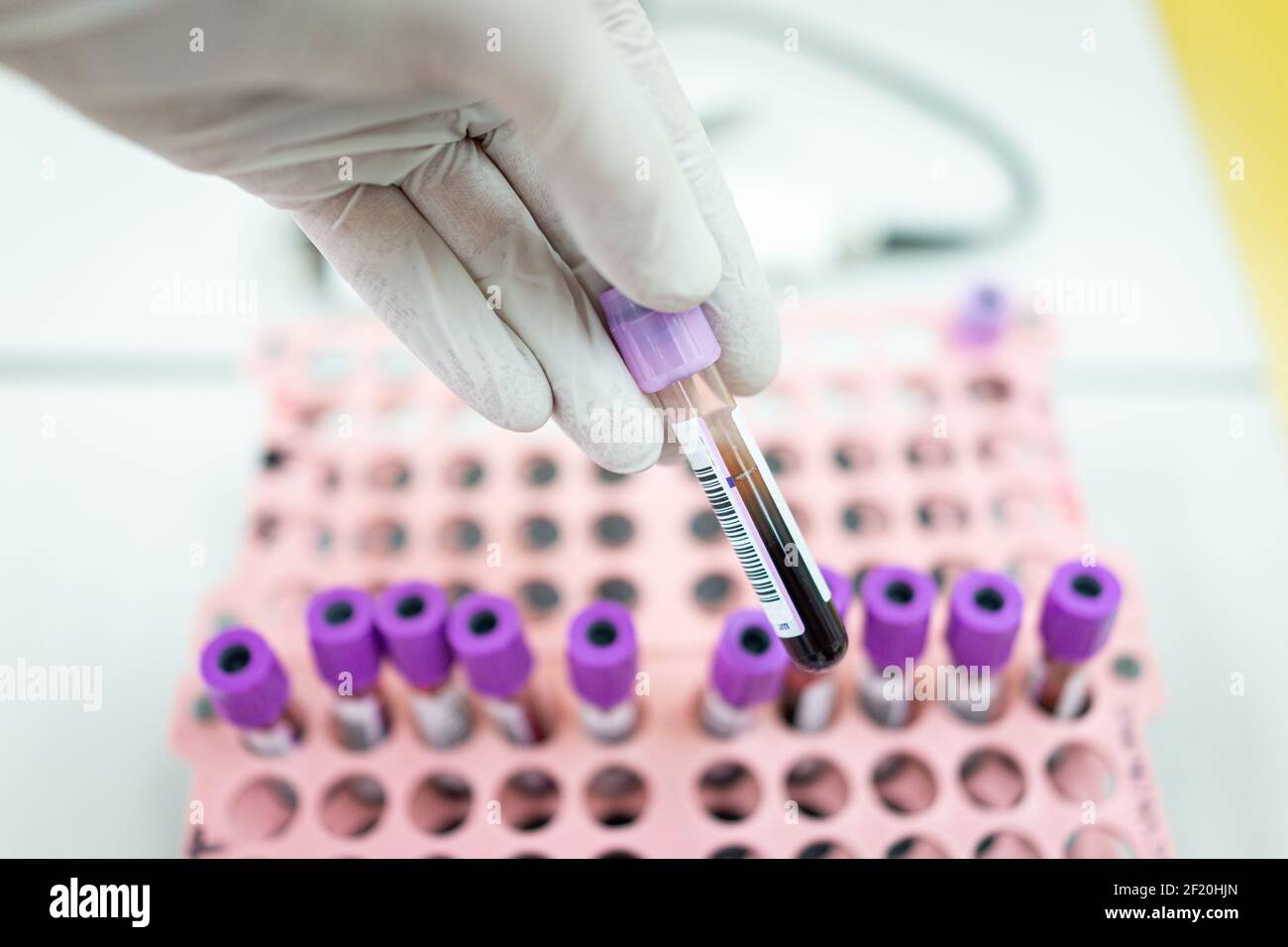 Hospital samples of donated blood indoors, high quality Stock Photo - Alamy
