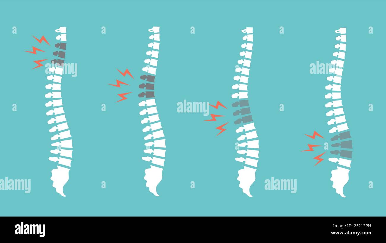 Back human skeleton icon Stock Vector Images - Alamy