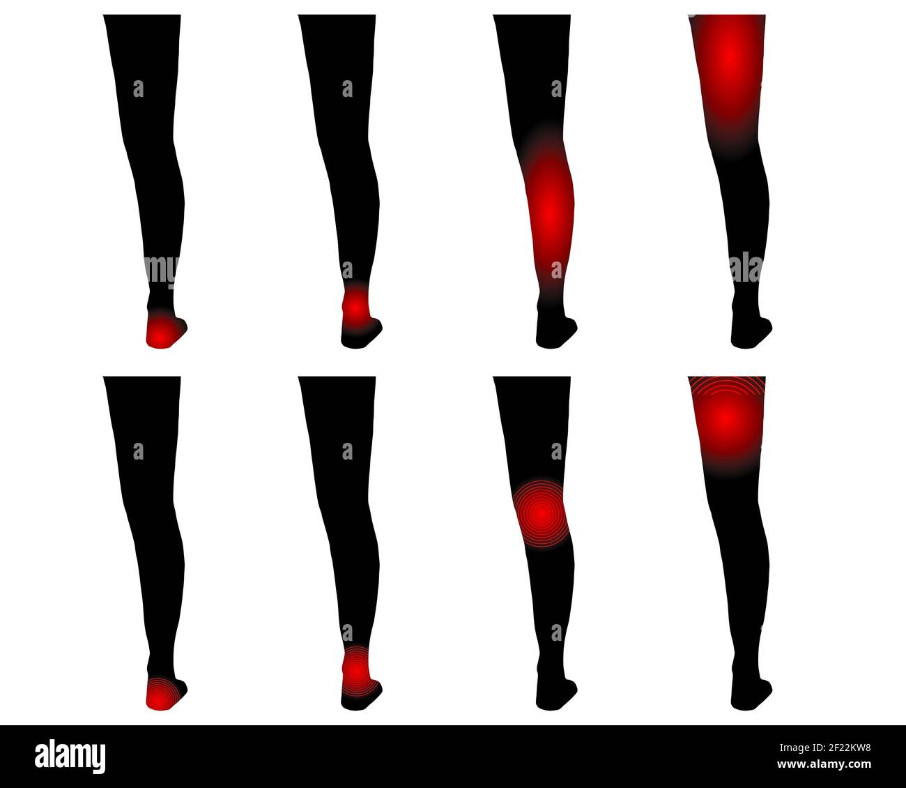 Human legs with pain points Stock Photo - Alamy