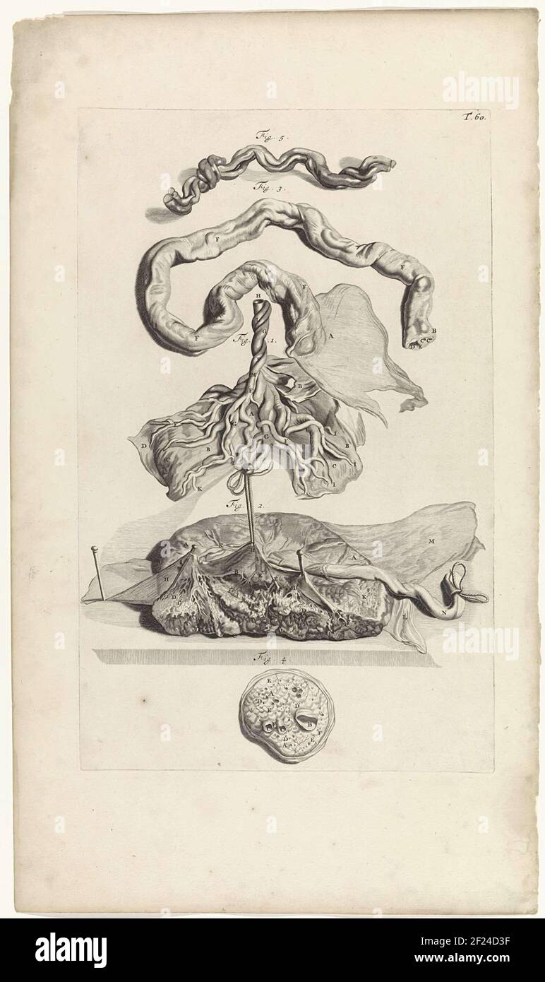 Anatomical study of the umbilical cord and a cross-section of the ...