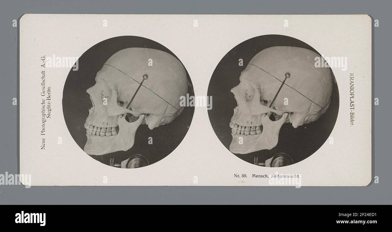 Human side view hi-res stock photography and images - Alamy