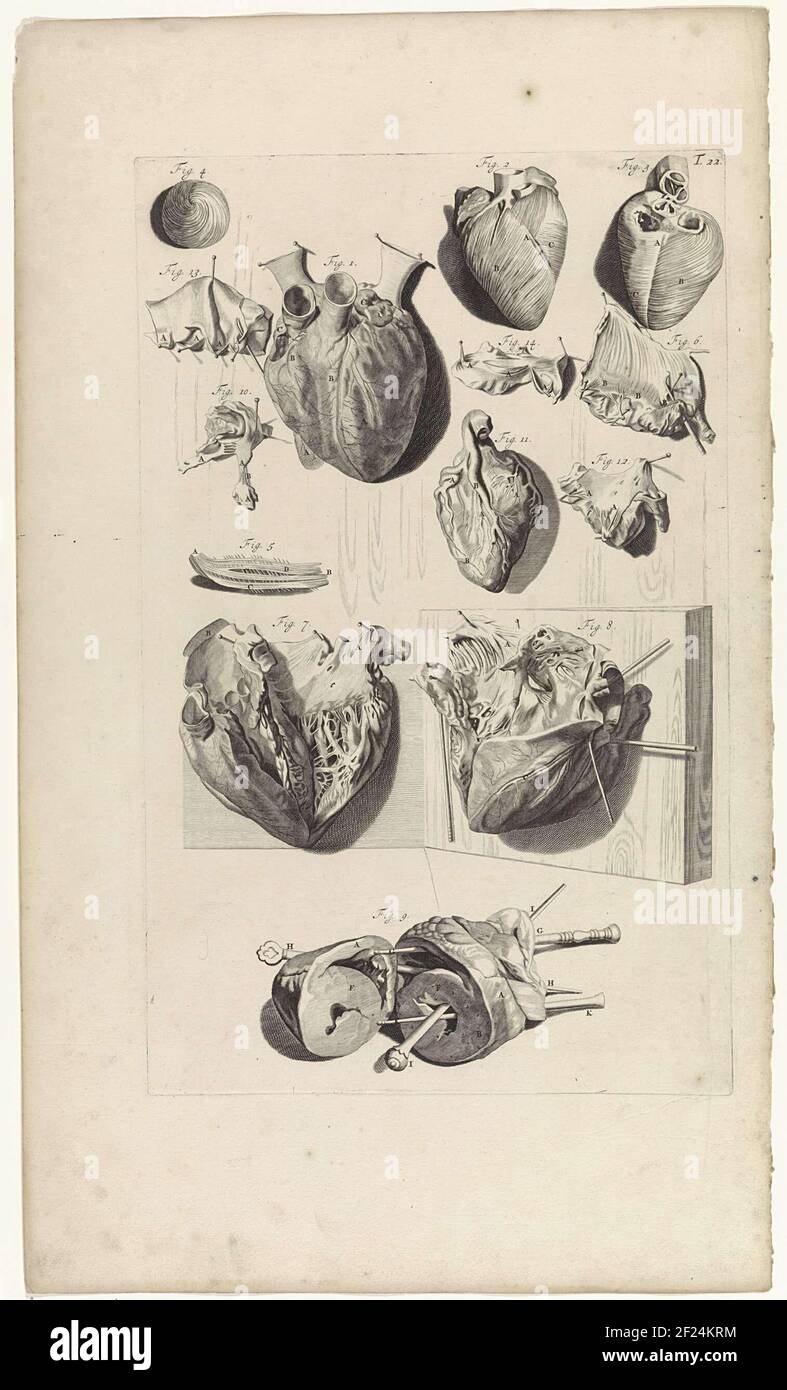 Anatomical study of the heart with dissection of the heart rooms. At ...