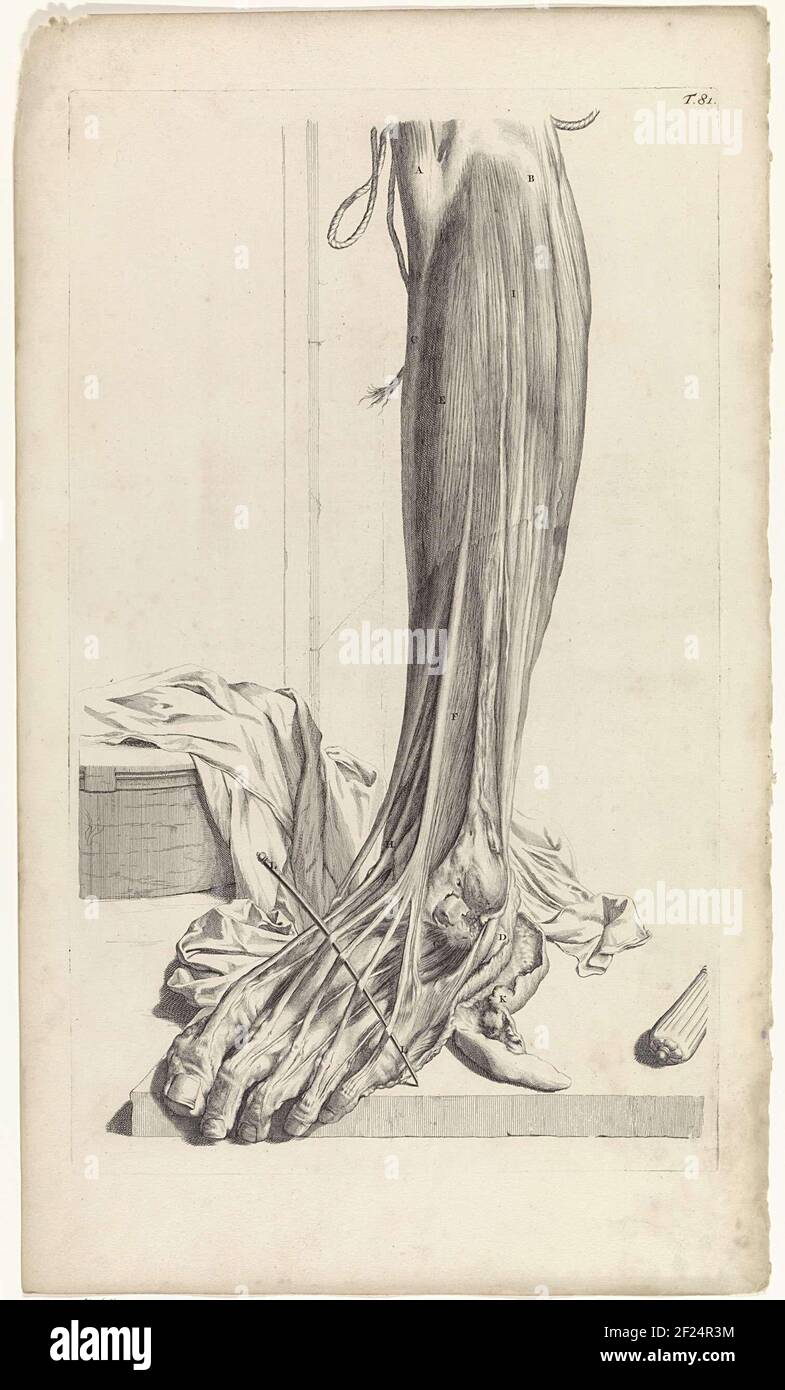 Anatomical study of the tendons of the right foot. At the top right ...