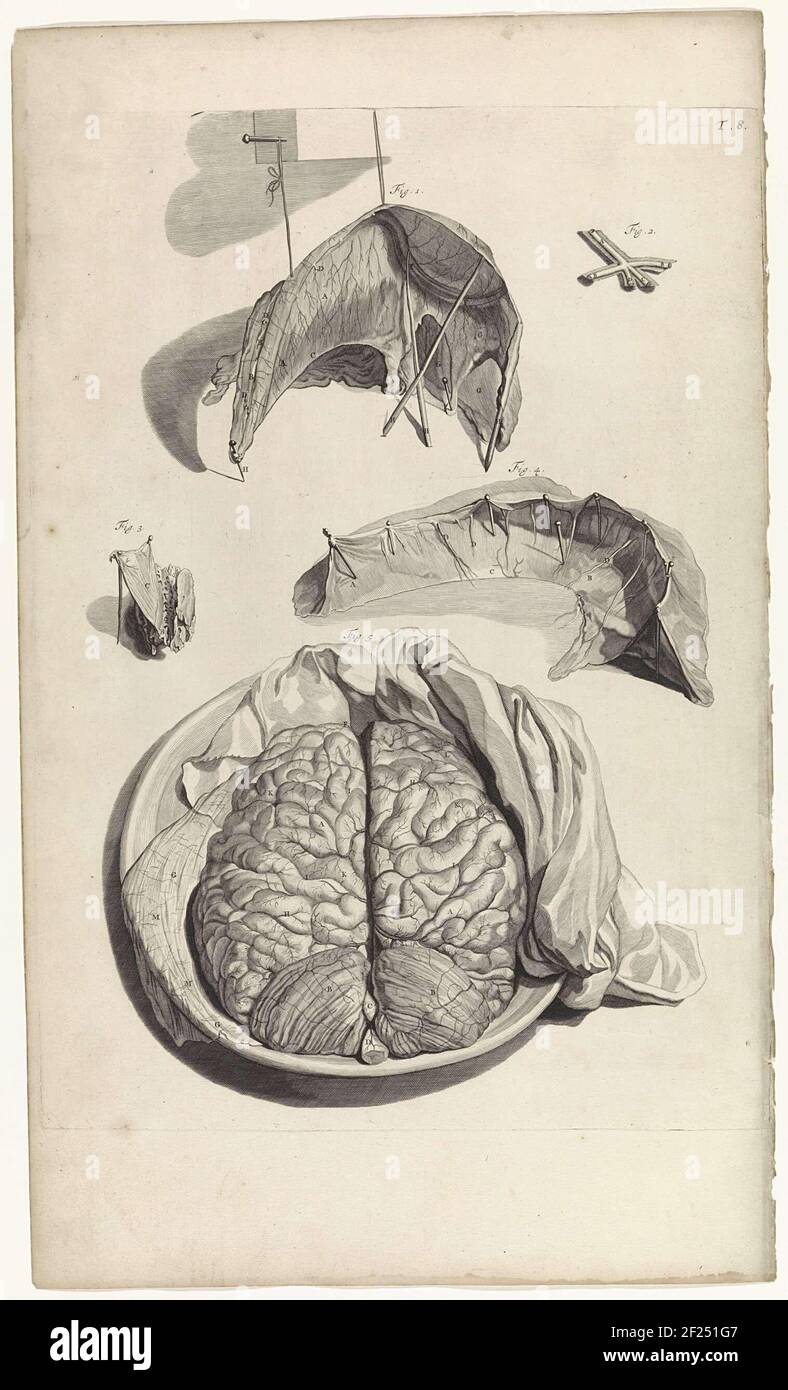 Anatomical study of parts of the skull. Under: Anatomical study of the ...