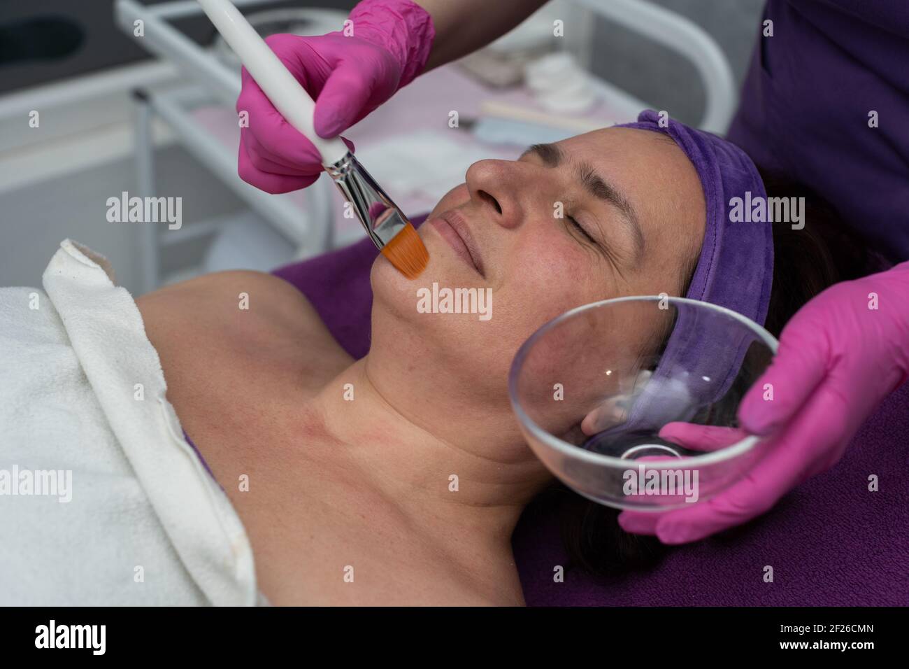 Peeling with acids. A beautician uses a brush to apply acid to the face ...