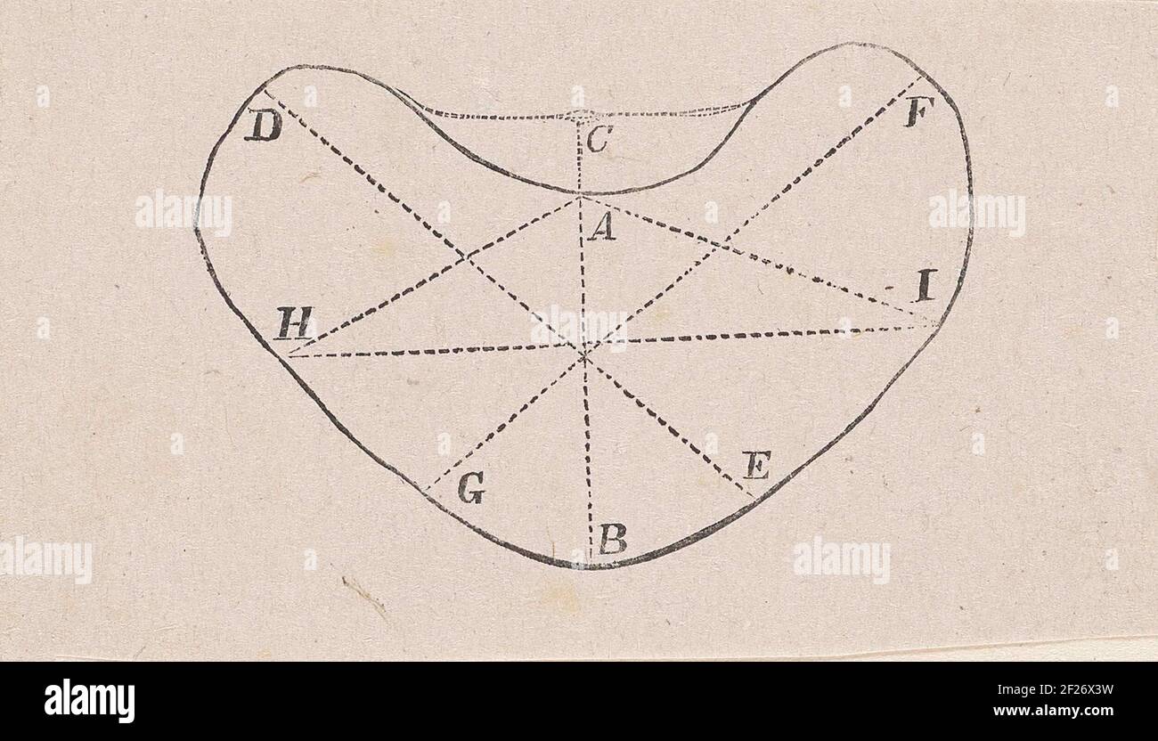 Part of the human body with a deviation Stock Photo - Alamy