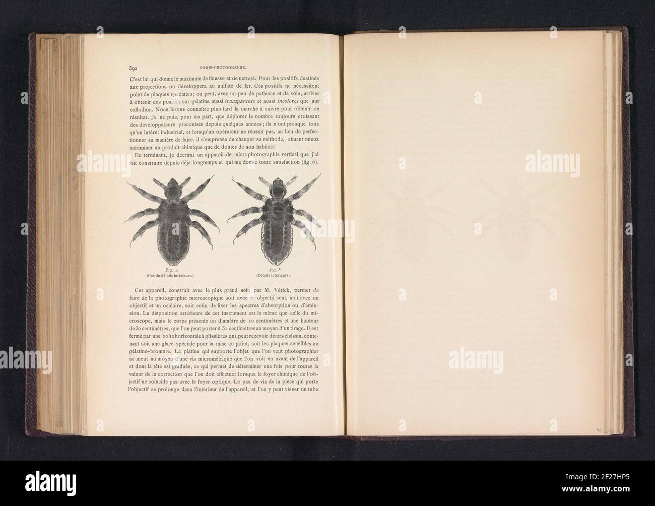 Lice solution hi-res stock photography and images - Alamy