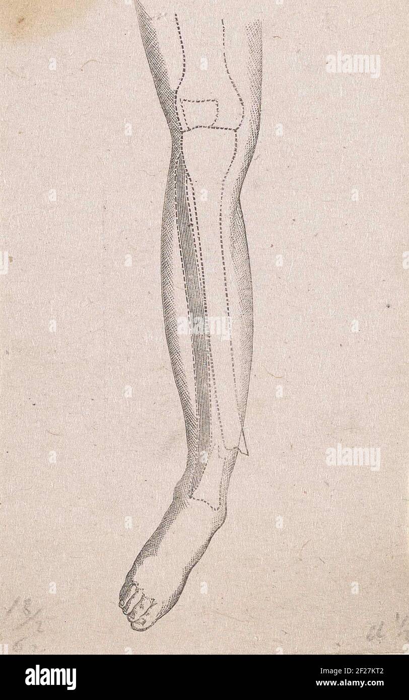 Human lower leg with a break in the bone Stock Photo - Alamy
