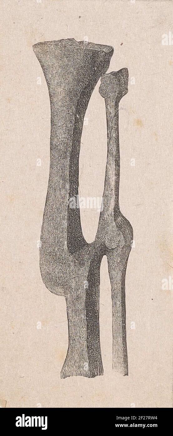 Human bone with a deviation Stock Photo - Alamy