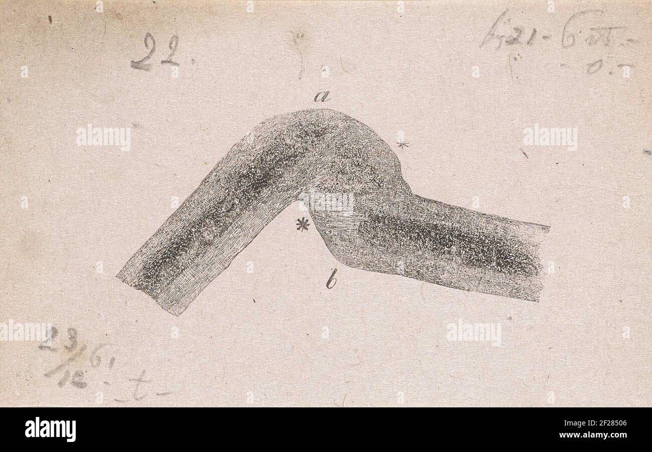 Part of the human body with a deviation Stock Photo - Alamy