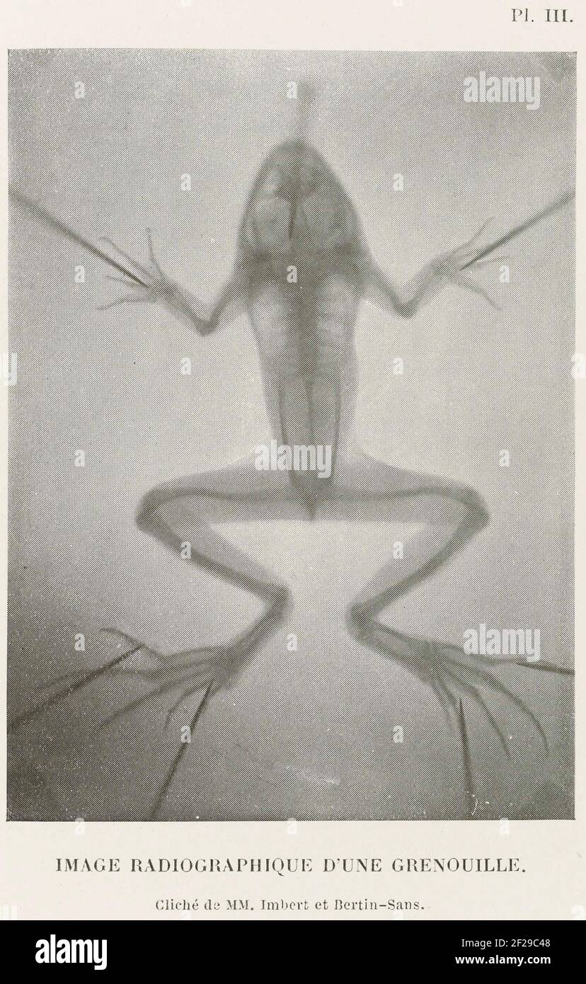 Radiographic anatomy hi-res stock photography and images - Alamy