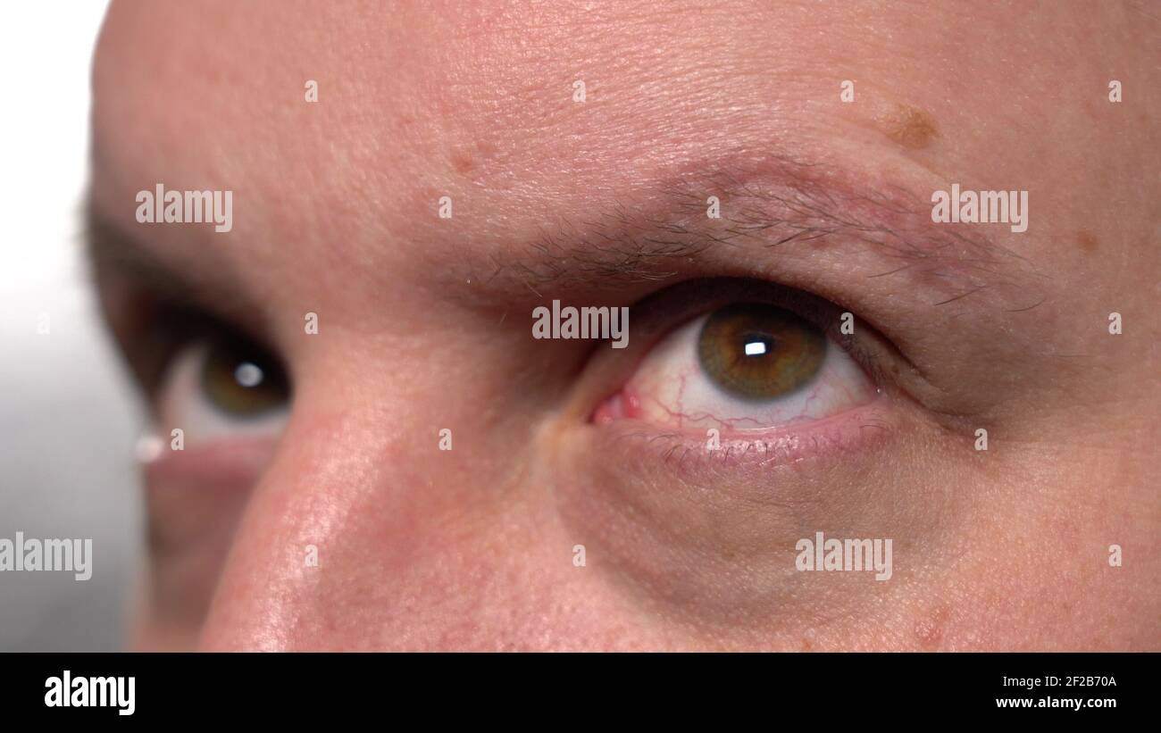 Rotate the Eyeball. The Eye of an Young Man with a Brown Cornea. Crazy ...