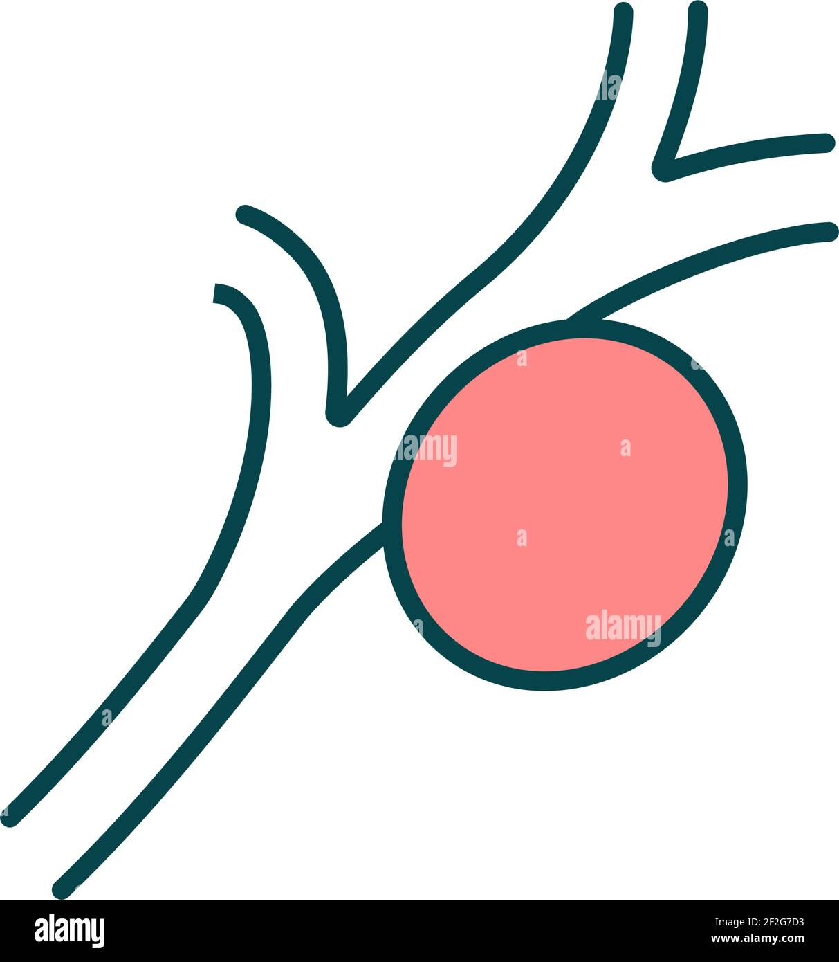 Aneurysm diagnosis Stock Vector Images - Alamy