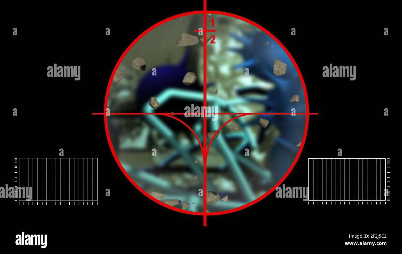 3D illustration - cancer cell with high details under microscope Stock ...