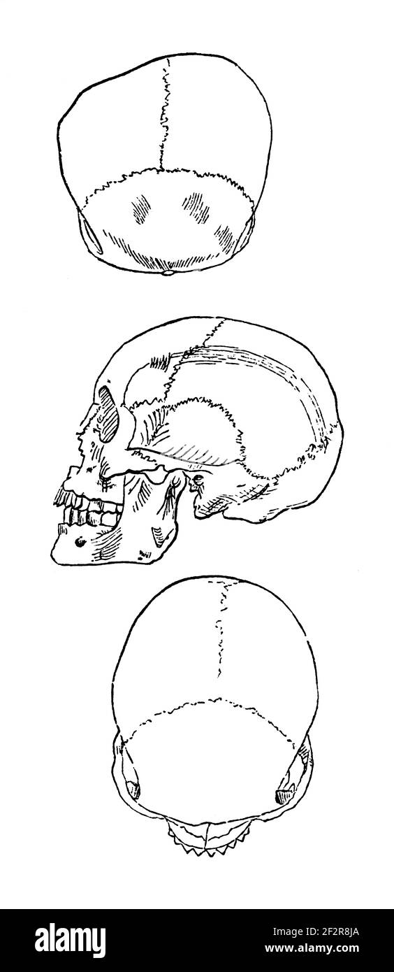 Antique 19th-century illustration of a skull from Samar Island ...