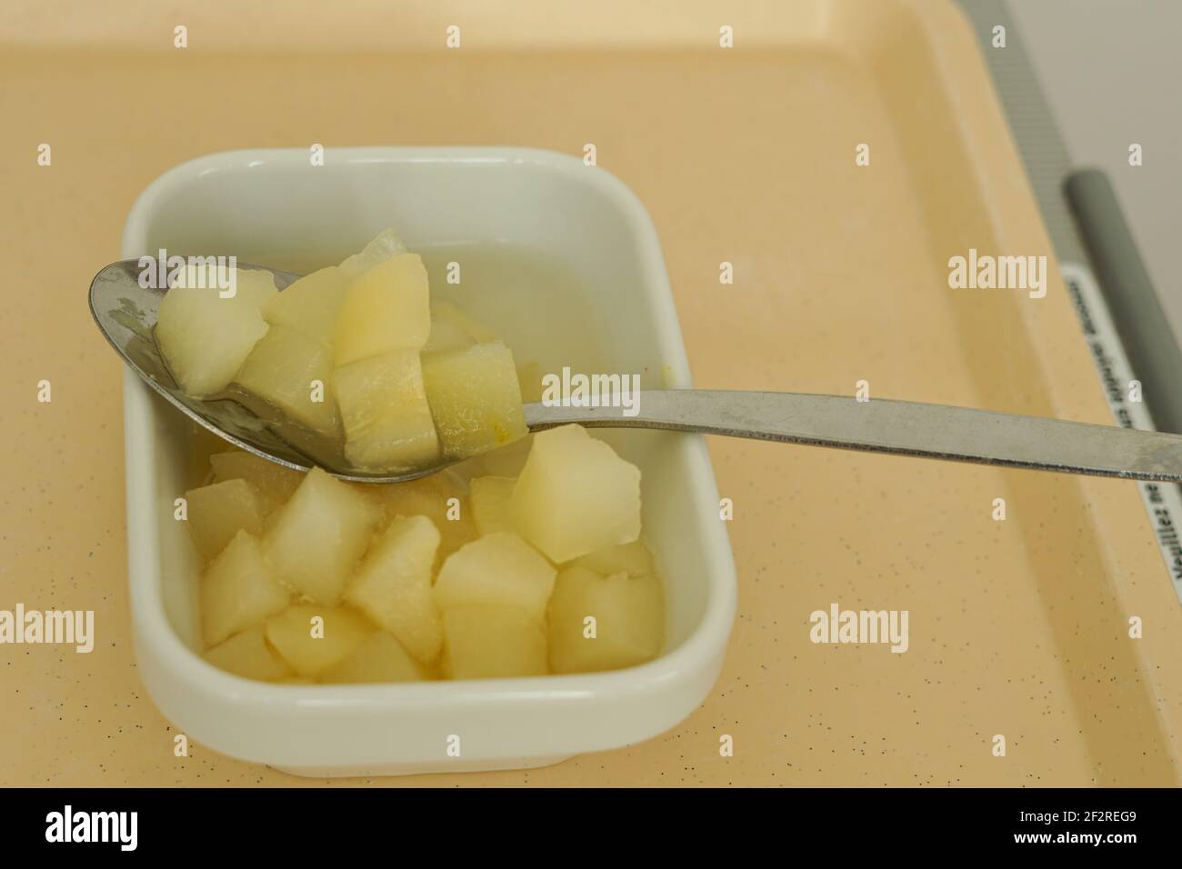 Fresh fruit in the hospital photographed on the tray with natural light ...