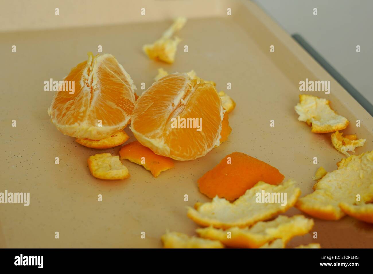 Fresh fruit in the hospital photographed on the tray with natural light ...
