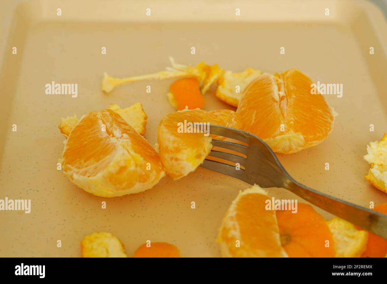 Fresh fruit in the hospital photographed on the tray with natural light ...