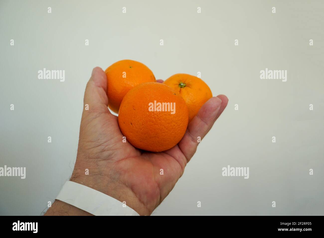 Fresh fruit in the hospital photographed on the tray with natural light ...