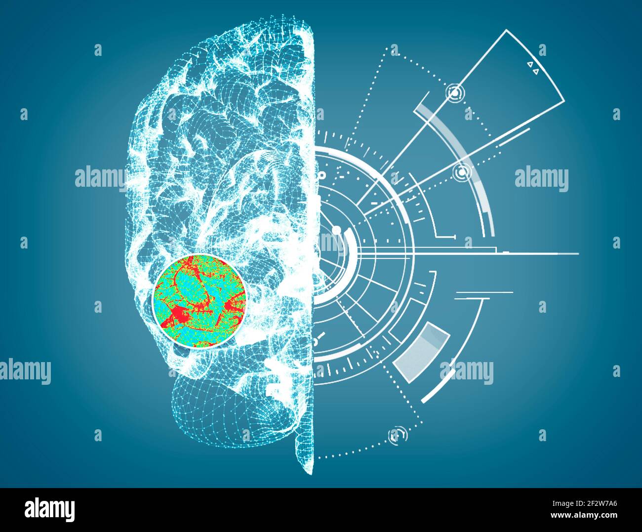 Pain in the head, brain and synapses, cognitive problems, mental ...