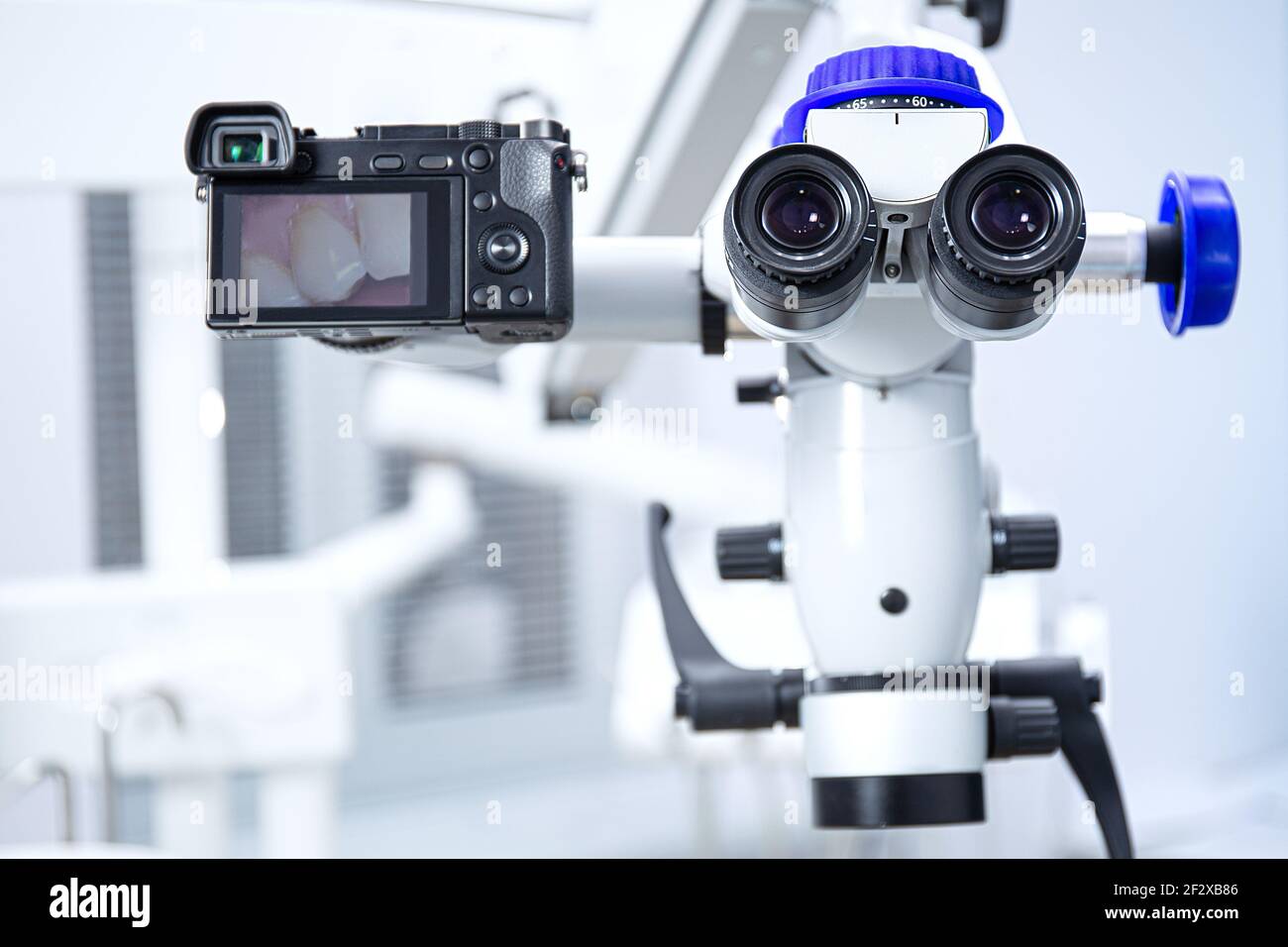 Professional Dental endodontic binocular microscope. Modern digital ...