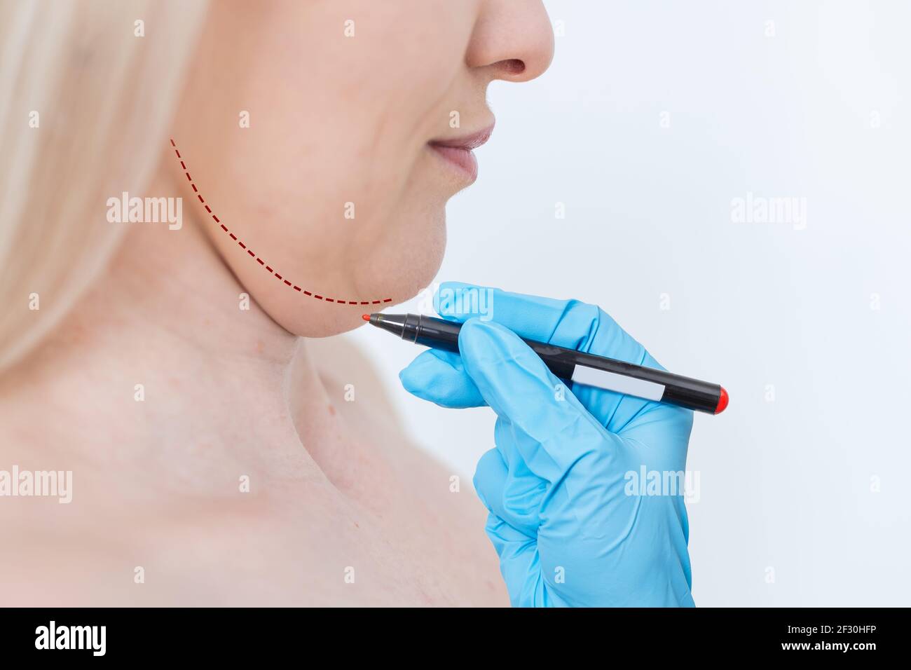 Closeup of woman's secong chin. Examining double chin, need facial line ...