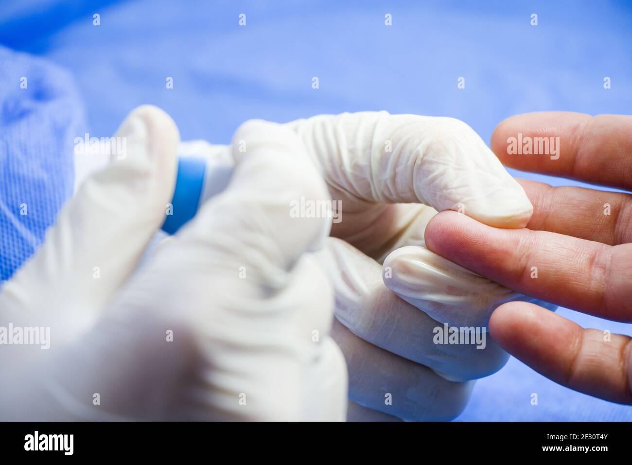 A closeup shot of the insulin testing process, taking a blood taste on ...