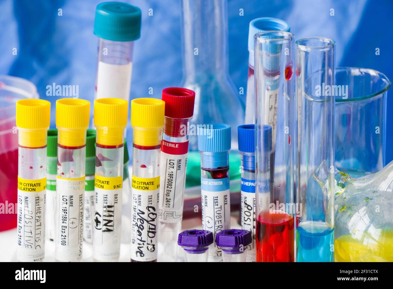 A closeup shot of blood test tube samples and medical glassware filled ...