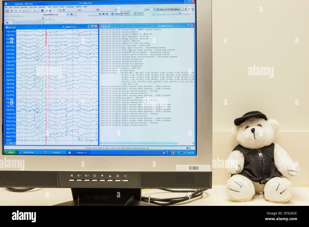 display showing neurological patient monitoring, Montreal Neurological ...