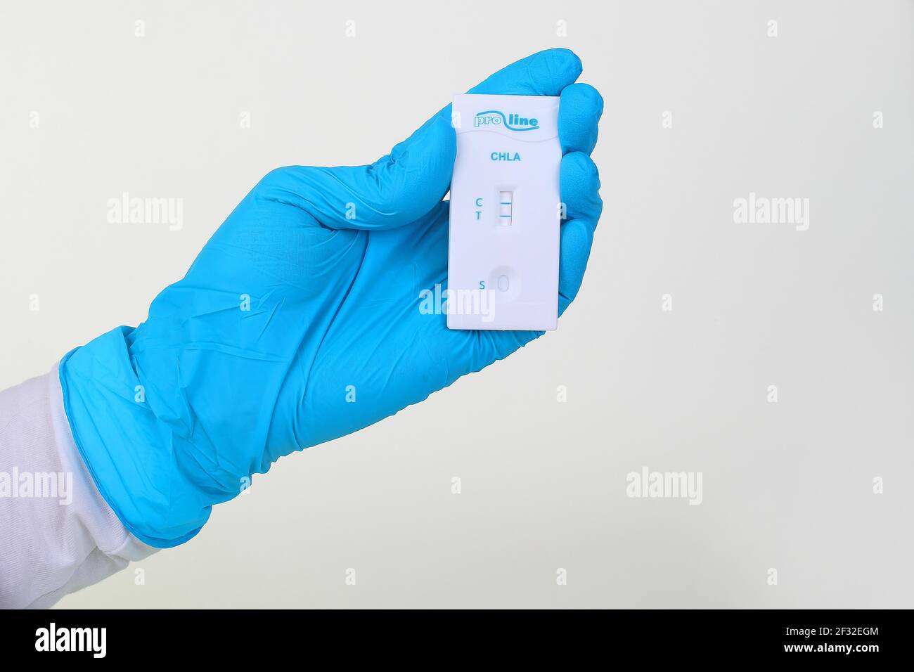 Quick test Chlamydia of the company ProLine, control and test strips ...