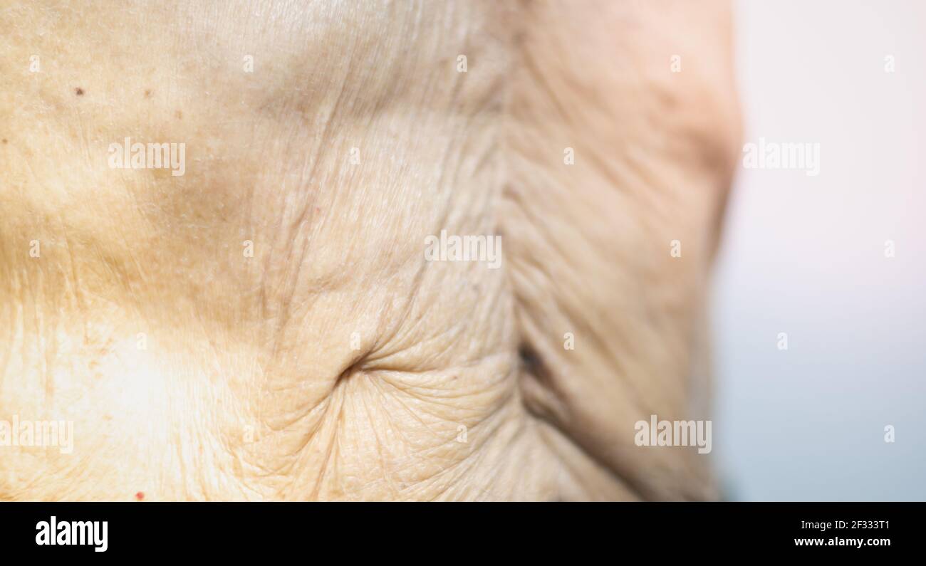 Atrophy Skin High Resolution Stock Photography and Images - Alamy