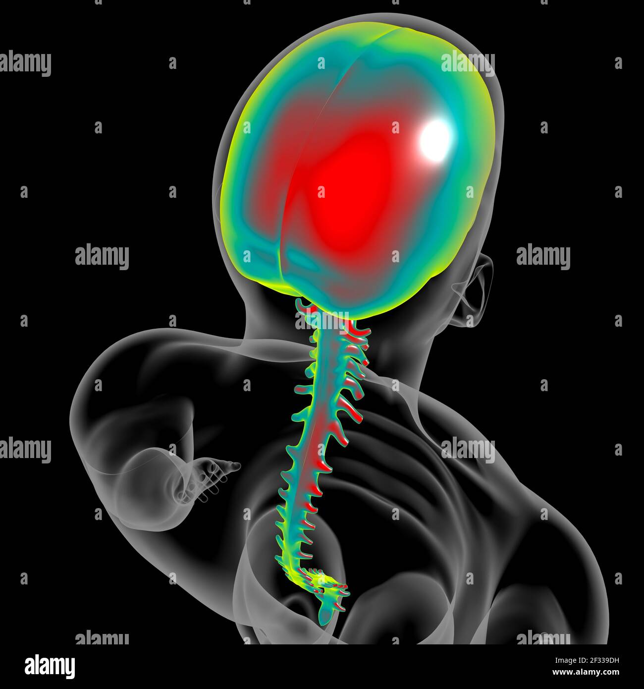 Dura mater hi-res stock photography and images - Alamy